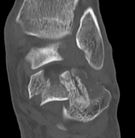 Management | The Bone School